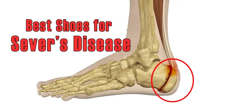 Best Shoes for Sever's Disease [2026] | Top [Reviews]